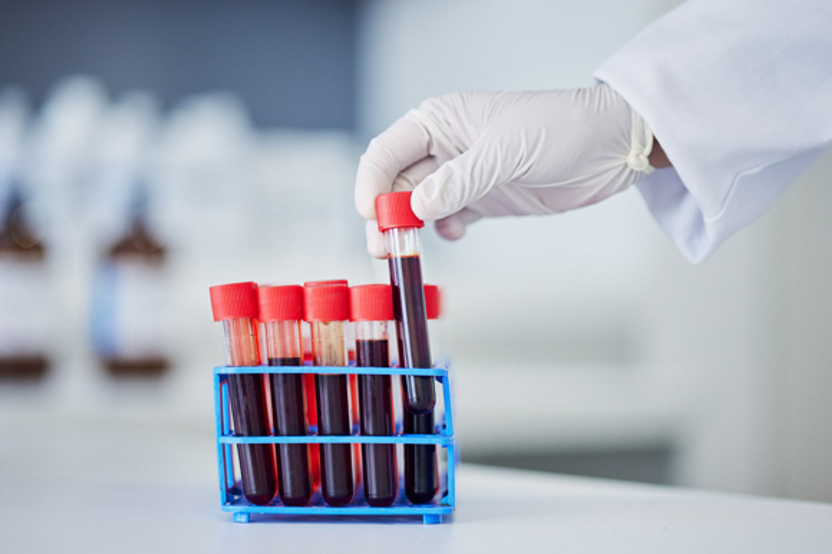 CitySprint | Specimen Transportation